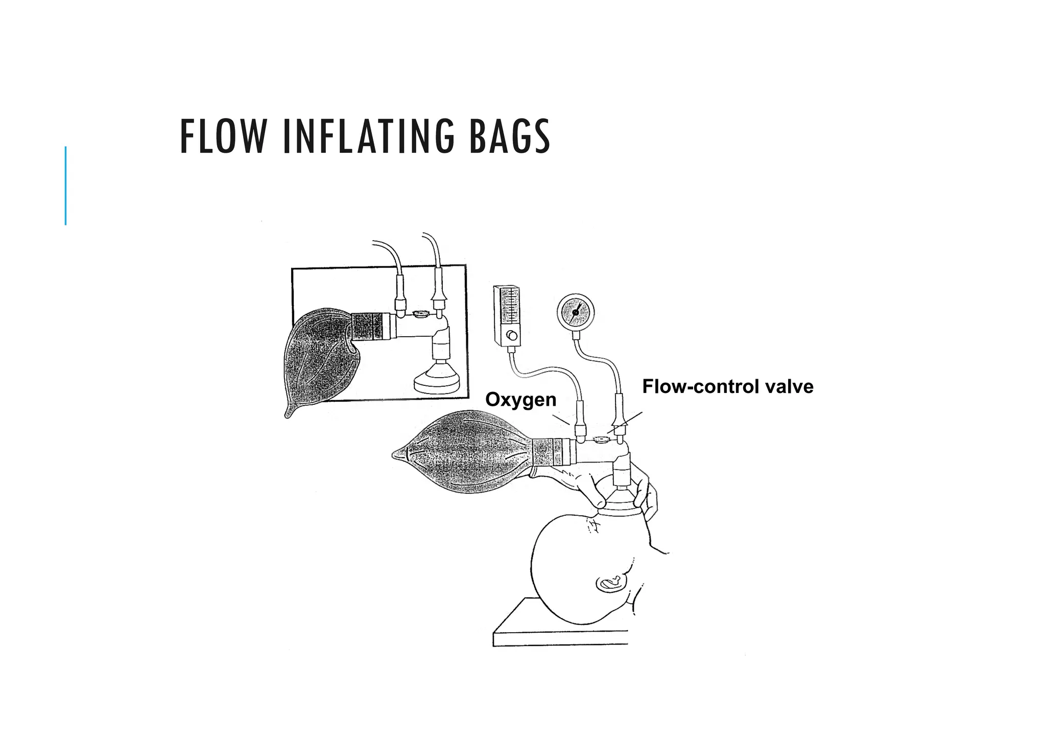 NnnnnNeonatal Resuscitation shortttt.pdf | First Aid | Injuries