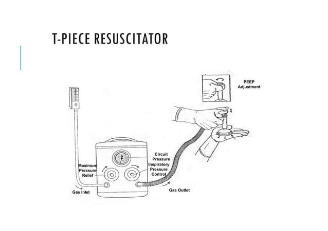 NnnnnNeonatal Resuscitation shortttt.pdf | First Aid | Injuries