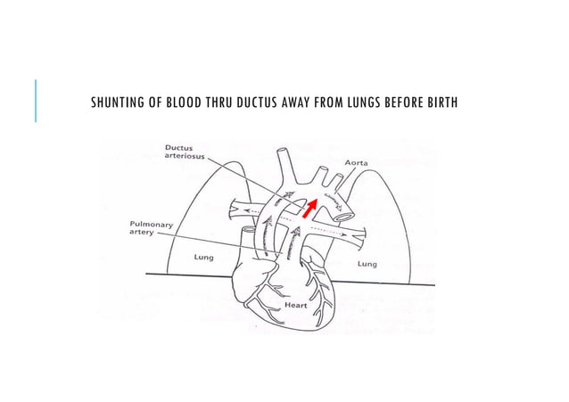 NnnnnNeonatal Resuscitation shortttt.pdf | First Aid | Injuries