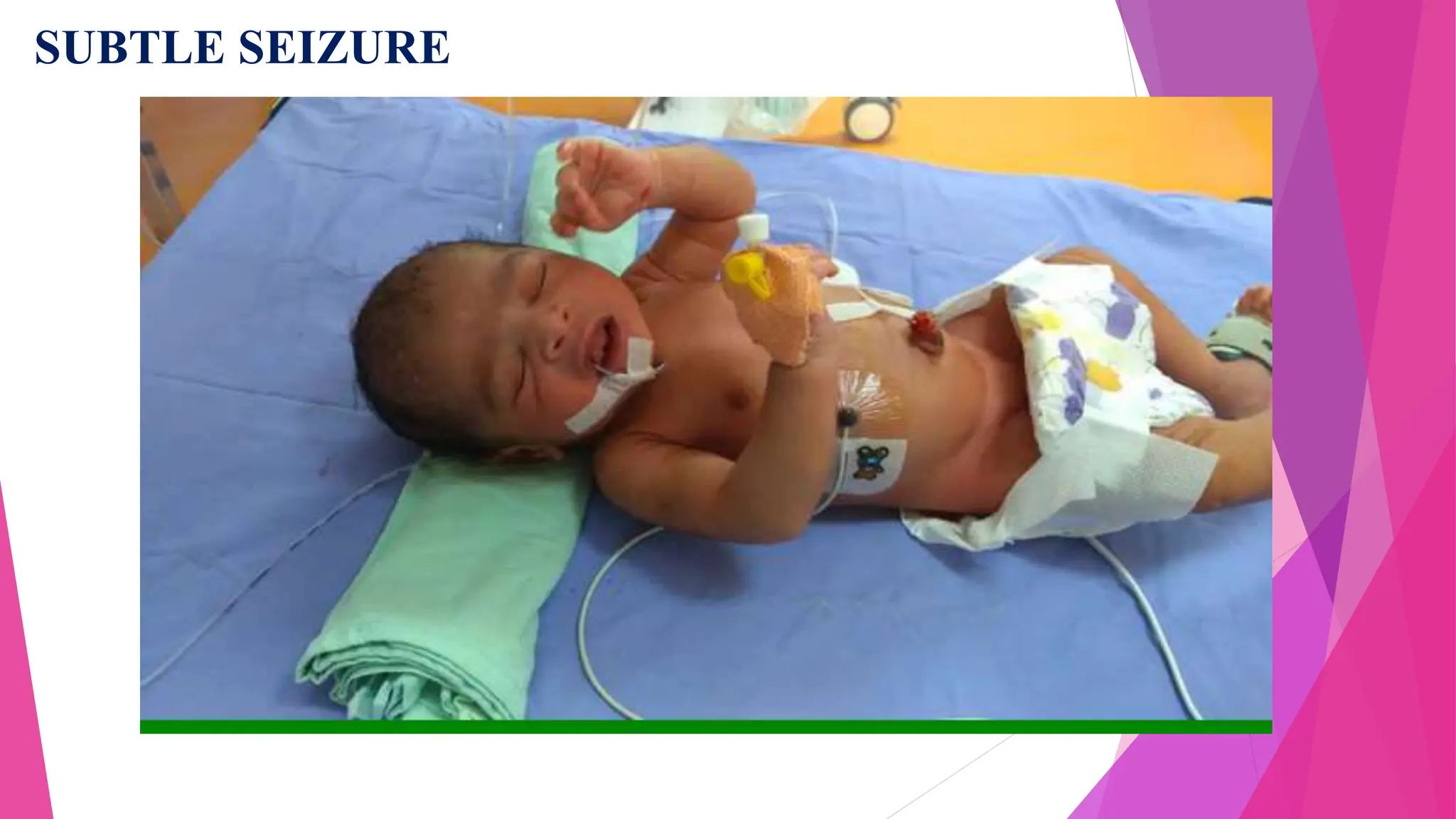 Neonatal seizure and its nursing management | PPTX