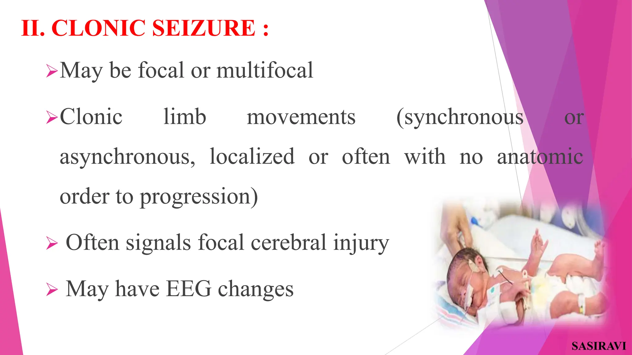 Neonatal seizure and its nursing management | PPTX
