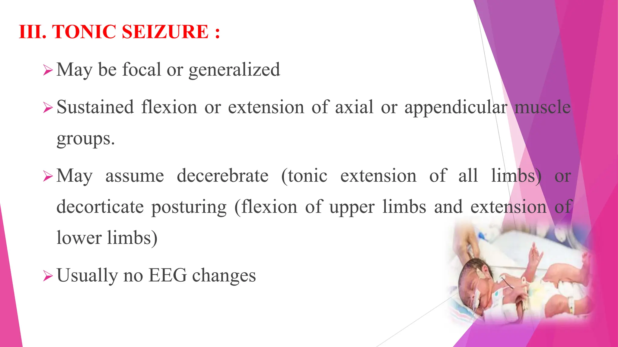 Neonatal seizure and its nursing management | PPTX