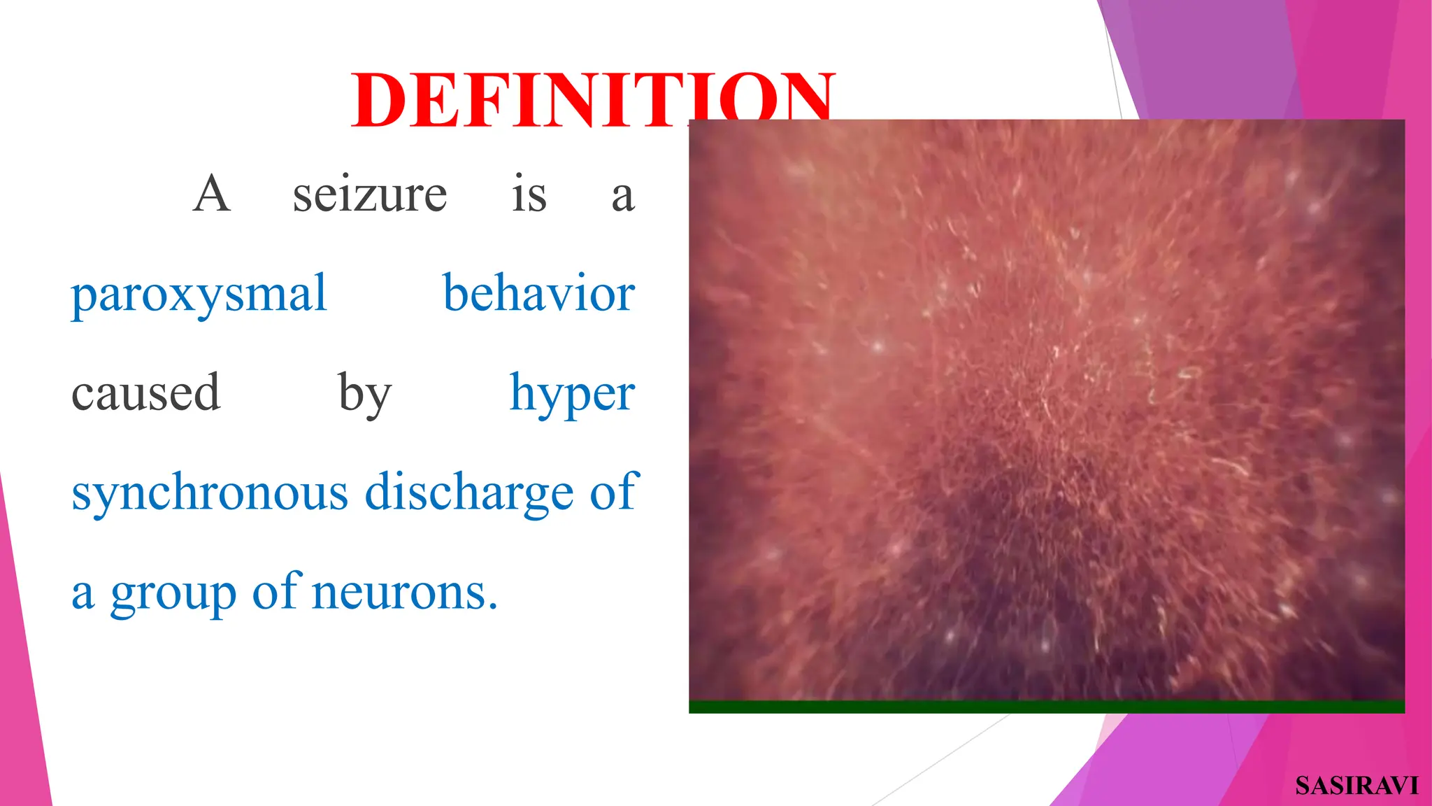 Neonatal seizure and its nursing management | PPTX