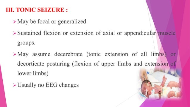 Neonatal seizure and its nursing management | PPTX | Pregnancy ...