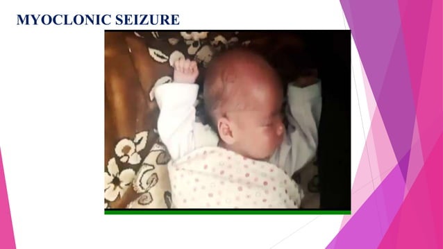 Neonatal seizure and its nursing management | PPTX | Pregnancy ...
