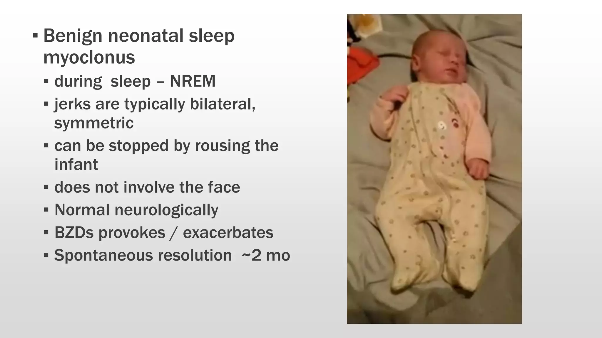 Neonatal seizure by dr praman | PPTX