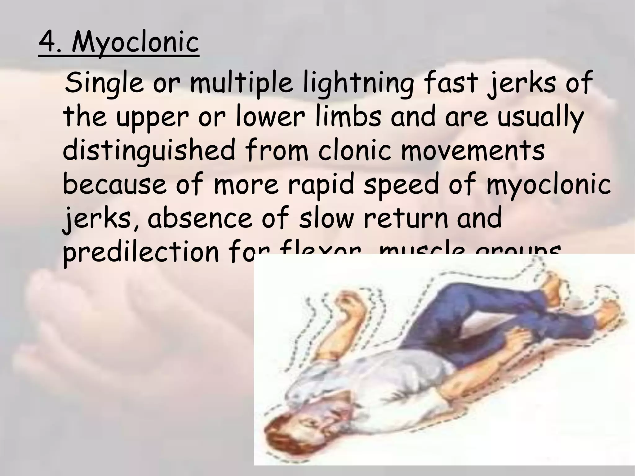Neonatal seizures | PPSX