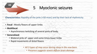 Neonatal seizures | PPTX