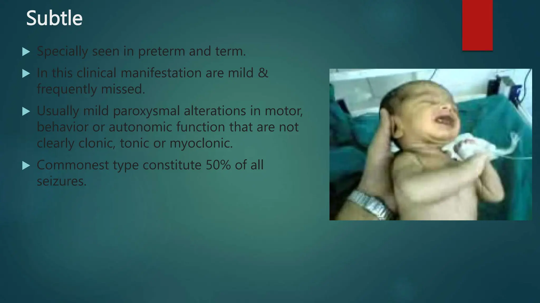 NeoNatal Seizures.pptx