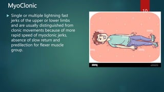 NeoNatal Seizures.pptx
