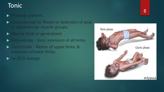 NeoNatal Seizures.pptx