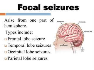 neonatal seizures all types of seizures | PDF