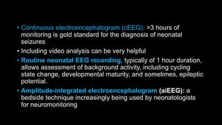 Neonatal Seizures.pptx