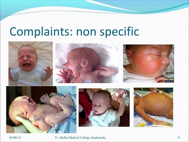 Neonatal sepsis | PPT