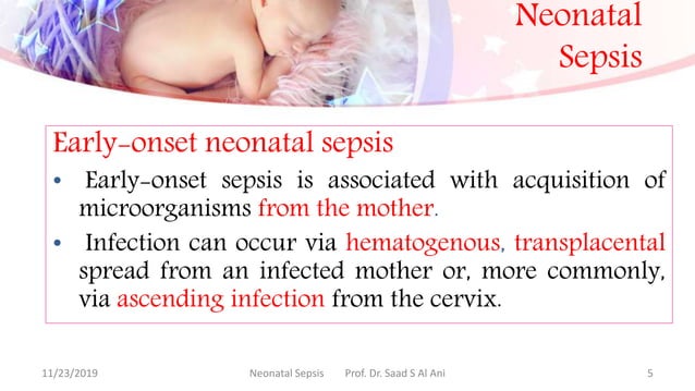 Neonatal sepsis | PPTX