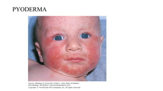 NEONATAL SEPSIS.pptx FOR REFERENCE OF BSC NURSING STUFENTS | PPT