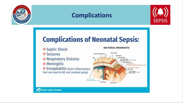 Neonatal sepsis approach and management.pdf