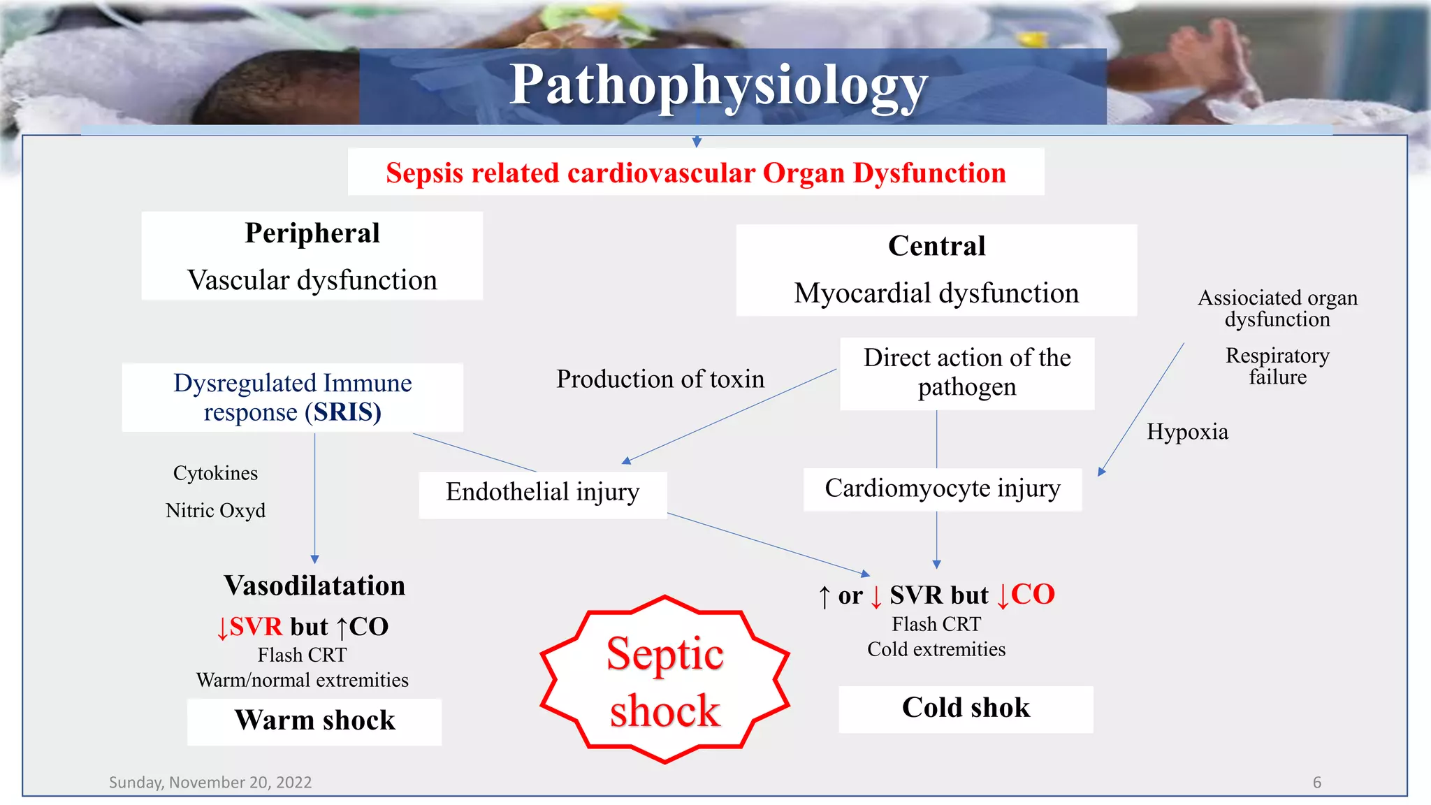 Neonatal sepsis : overview of epidemiology, pathogenesis ...