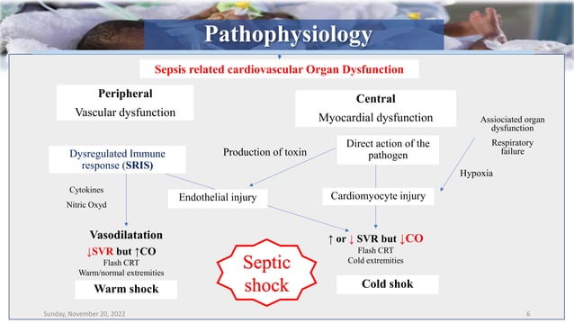 Neonatal sepsis : overview of epidemiology, pathogenesis ...