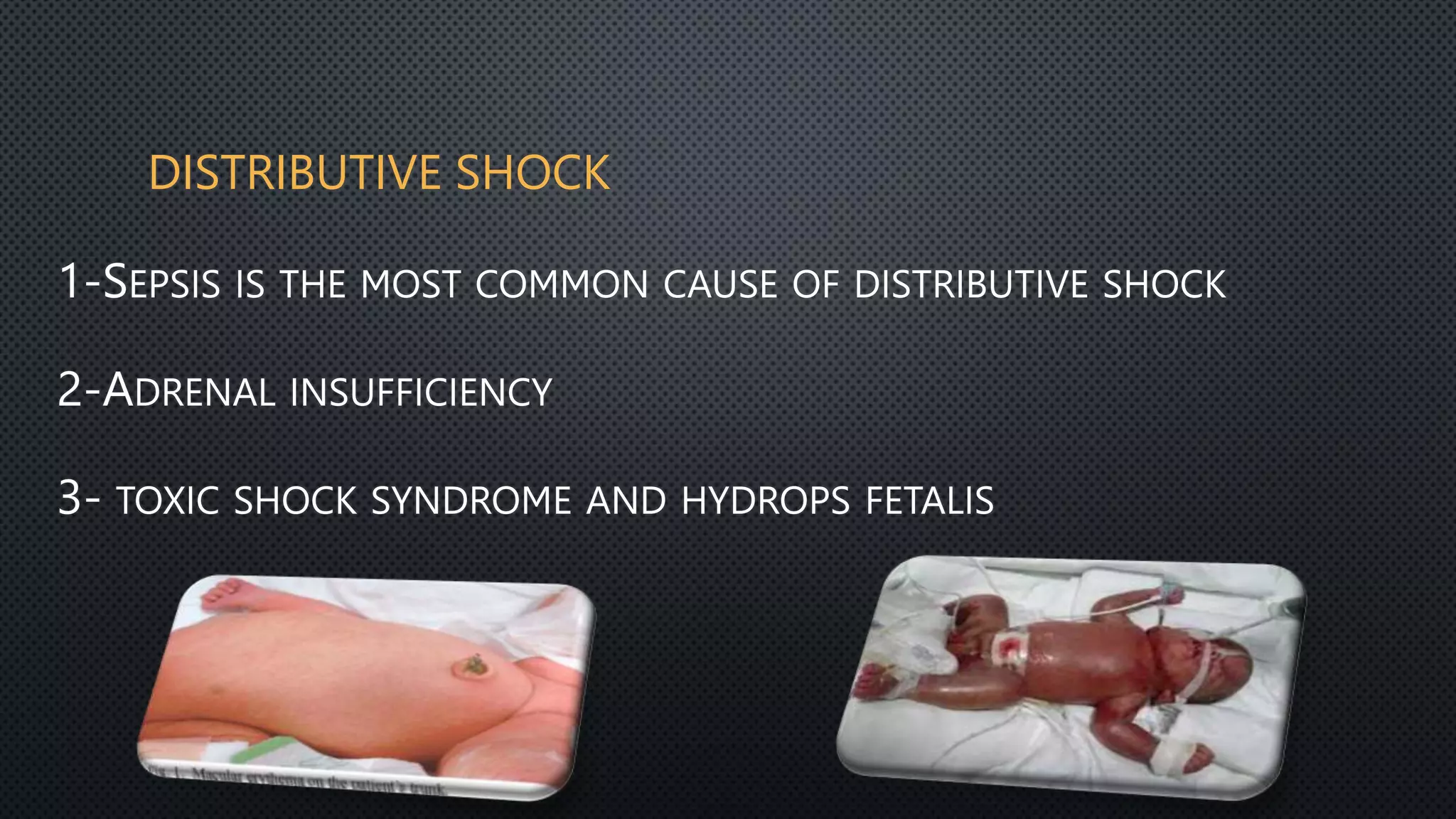 Neonatal shock management [Autosaved].pptx