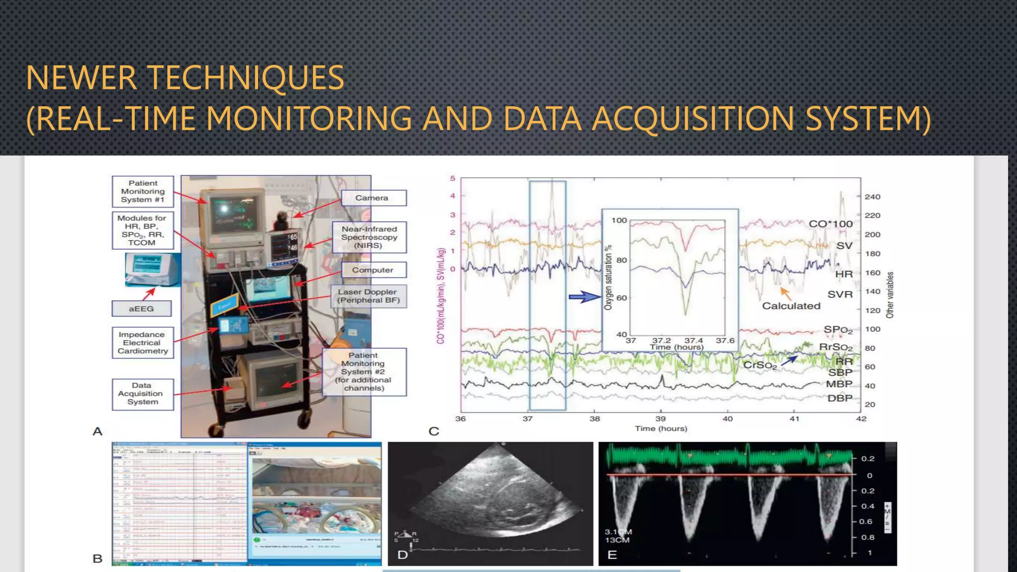 Neonatal shock management [Autosaved].pptx