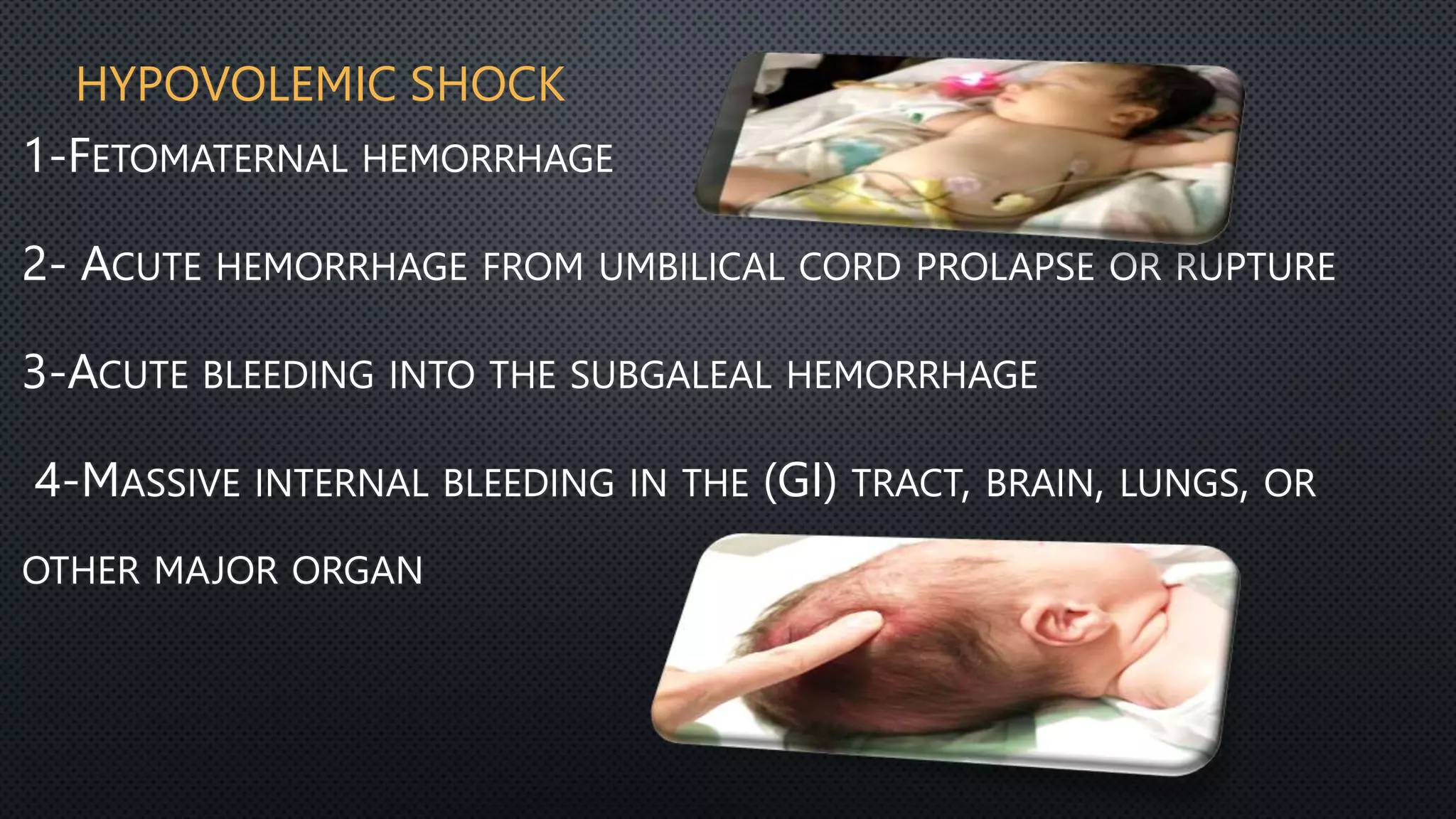 Neonatal shock management [Autosaved].pptx