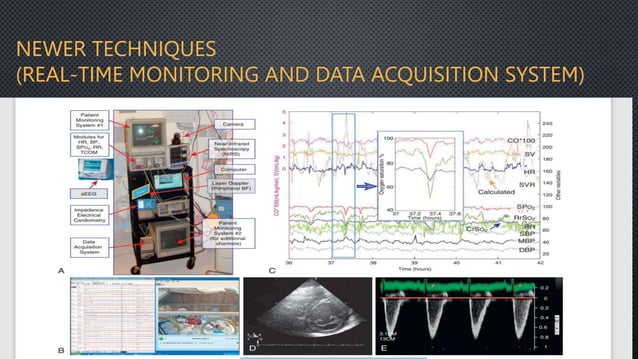 Neonatal shock management [Autosaved].pptx