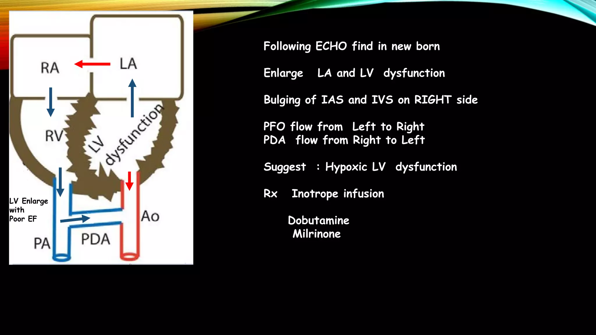 Neonatal shock may 2021 | PDF
