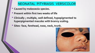 NEONATAL SKIN DISEASES 2.pdf