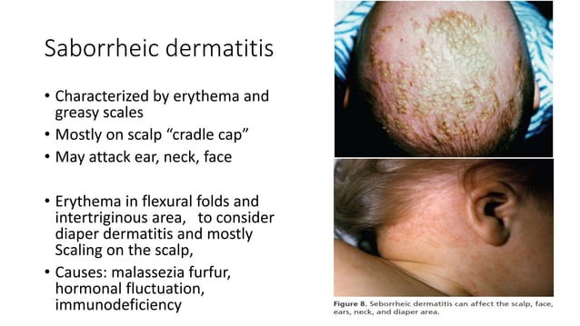 Neonatal skin rashes | PPTX