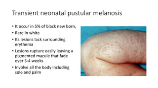 Neonatal skin rashes | PPT