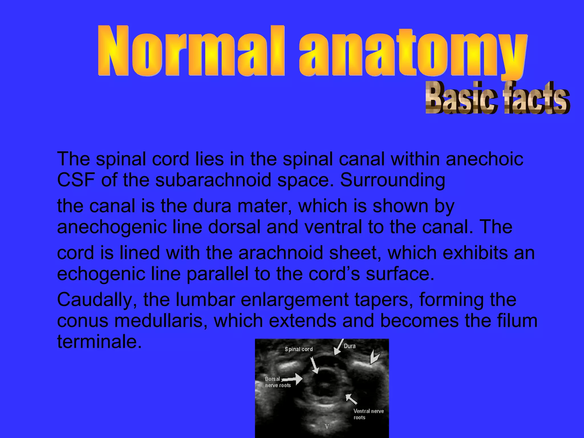 Neonatal spine ultrasound...normal and abnormal findings | PPT