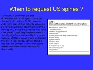 Neonatal spine ultrasound...normal and abnormal findings | PPT
