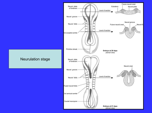 Neonatal spine ultrasound...normal and abnormal findings | PPT ...