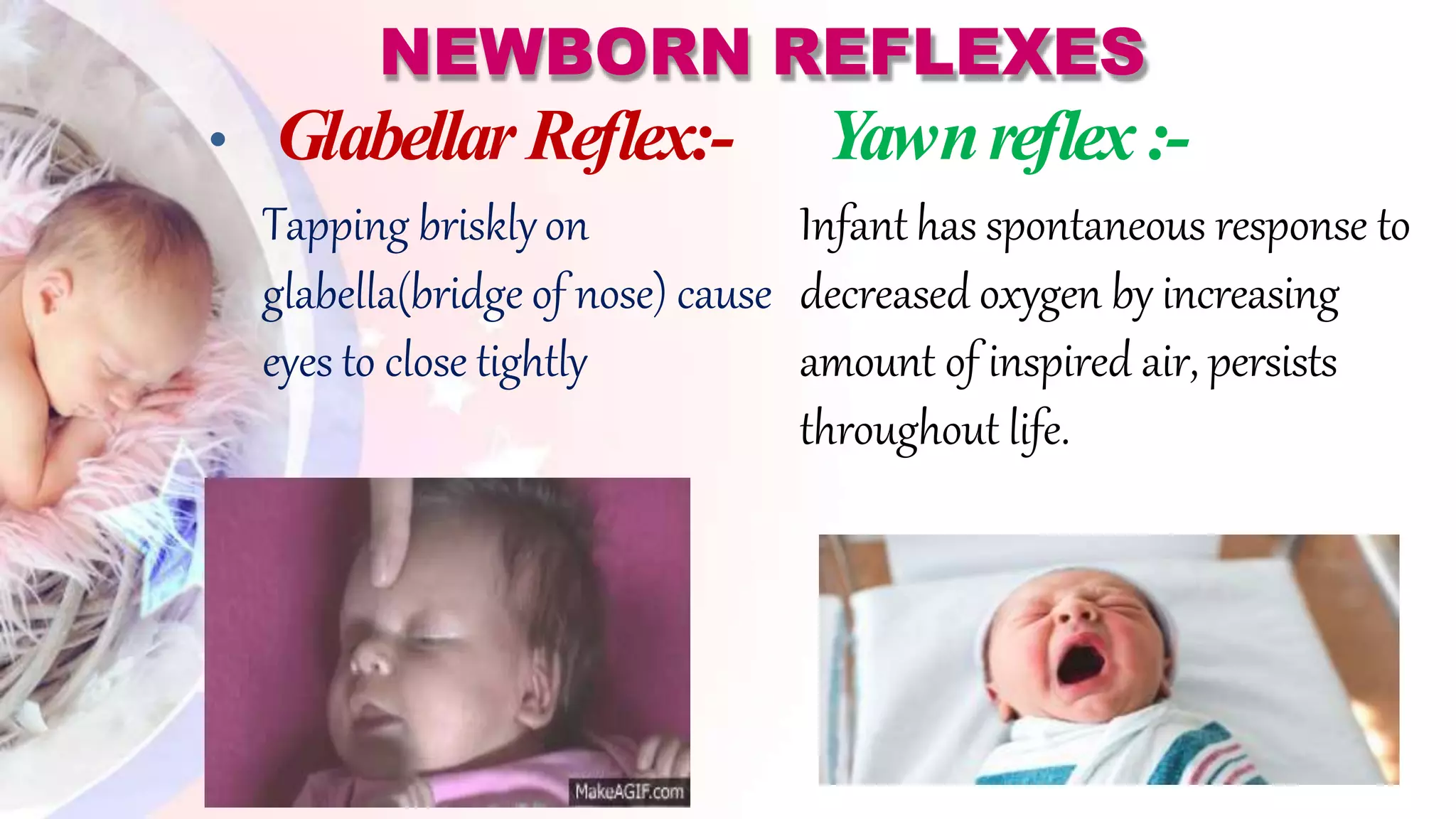 neonatal stage.pptx