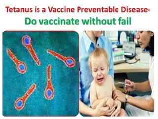 Neonatal tetanus | PPTX