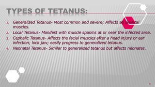 Neonatal tetanus | PPTX