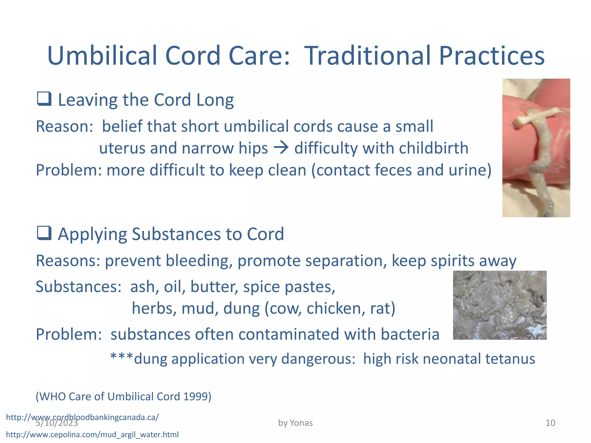 Neonatal TETANUS (1).pptx