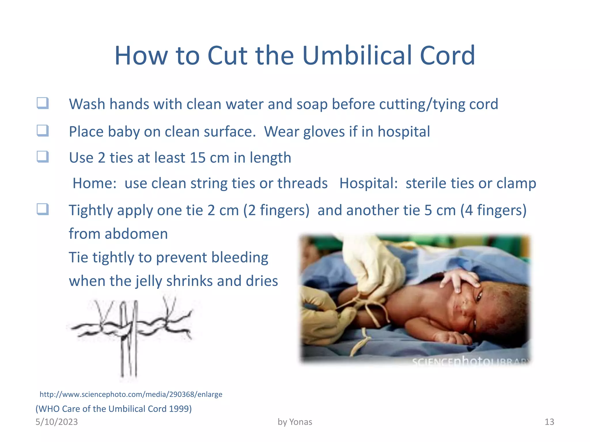Neonatal TETANUS (1).pptx