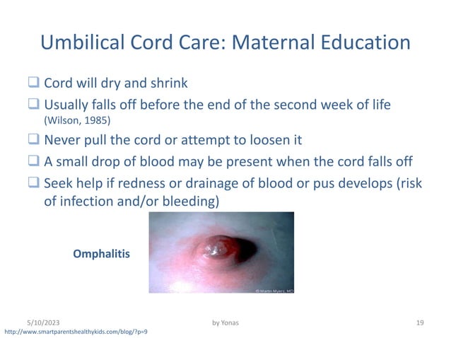 Neonatal TETANUS (1).pptx
