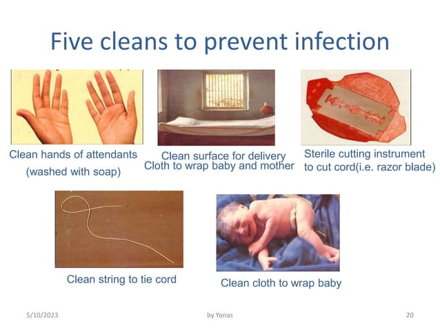 Neonatal TETANUS (1).pptx