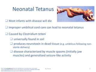 Neonatal TETANUS (1).pptx