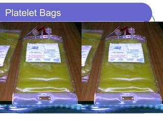 Neonatal thrombocytopenia | PPT