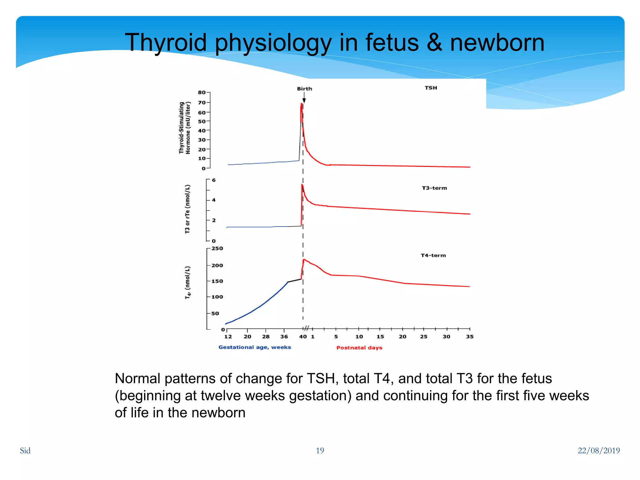 Neonatal Thyrotoxicosis | PDF