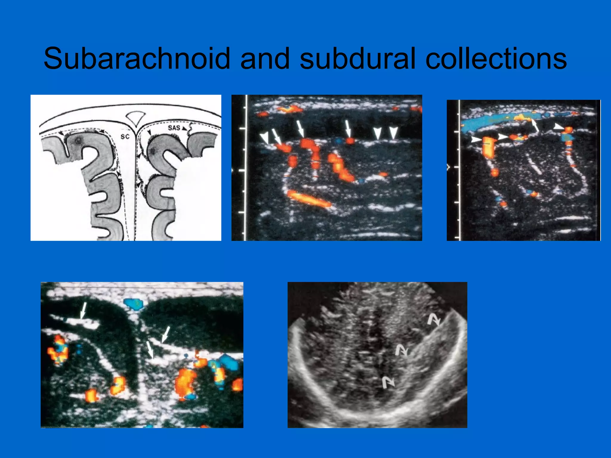 Neonatal transcranial ultrasound | PPT