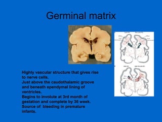 Neonatal transcranial ultrasound | PPT