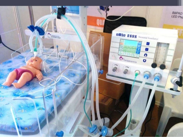 Neonatal ventilator presentation