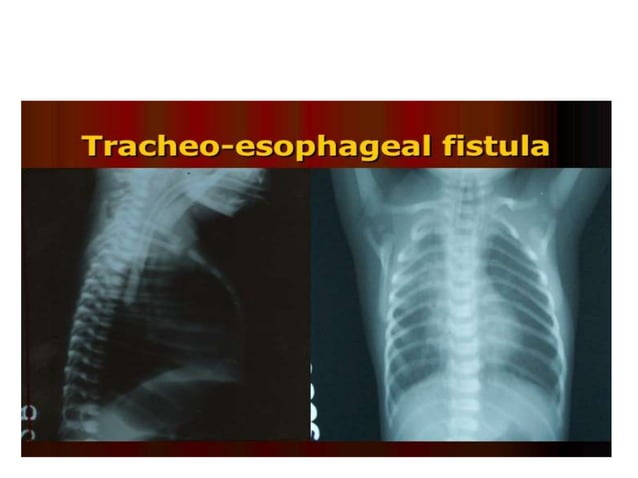 Neonatal warning signs | PPTX | Pregnancy | Reproductive Health