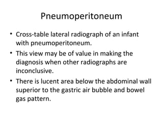 Neonatal xray & spots git | PPT