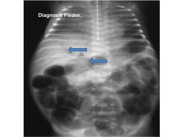 Neonatal xray & spots git